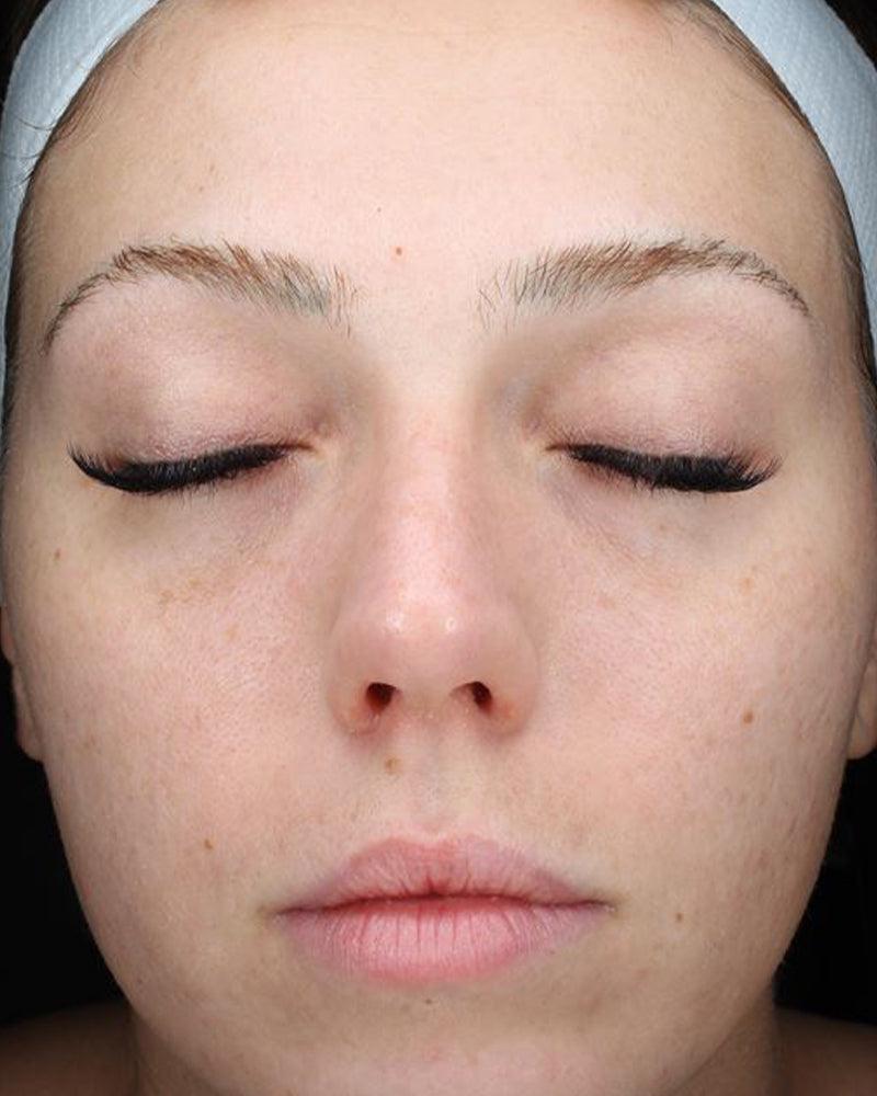 Real Skin Results | RATIONALE Before + After